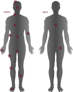 Body Scan Tool Questionnaire - Circle of Wellness